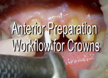 CADStar CEREC Learning Center | CADStar