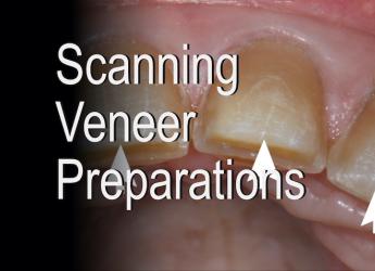 CADStar CEREC Learning Center | CADStar