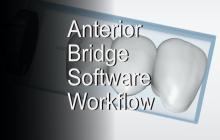 Streamlining the CEREC Software Design Process | CADStar