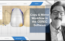Streamlining the CEREC Software Design Process | CADStar